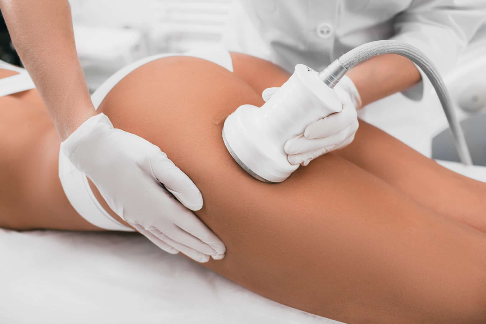 Ultrasound cavitation & RF Skin Tightening – Super Soft Laser Clinic